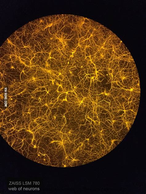 Web Of Nerve Cells Real Microscopy Photo 9GAG