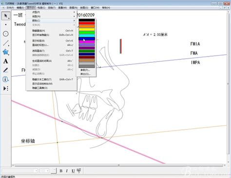 Tweed分析法模板制作 V5 第二节于吉冬原创 于吉冬的博客 KQ88口腔博客