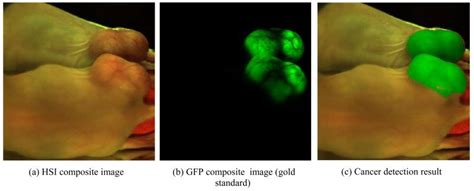 spectral spatial classification using tensor modeling for cancer detection with hyperspectral