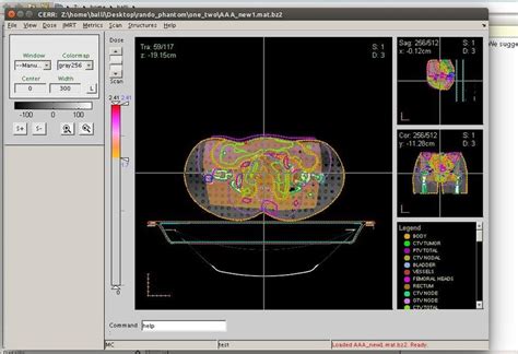 the dose distribution obtained with monte carlo simulation for the four download scientific