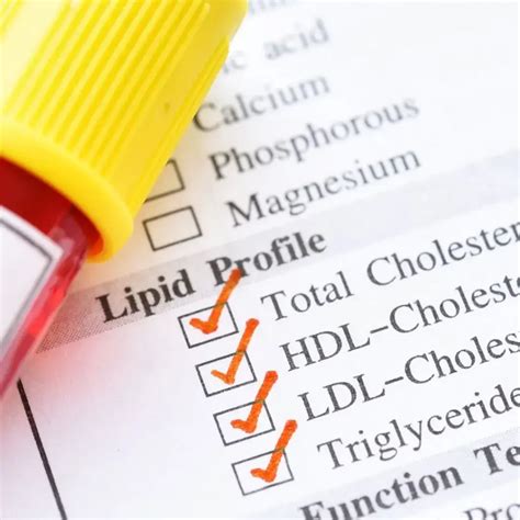 Lipid Profile Test American Medical Center UAE