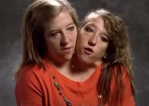 Conjoined Twin Abby Hensel Gets Married See Her First Dance Here