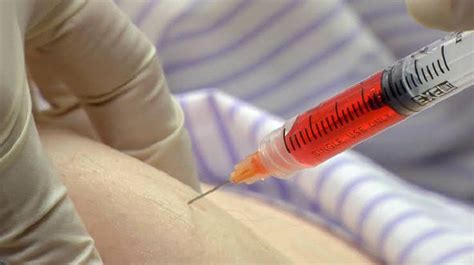 What Are Vitamin B Injections Used For