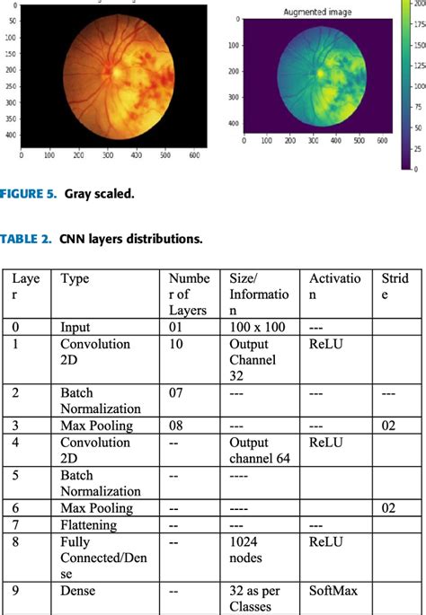 figure 1 from multi class retinal diseases detection using deep cnn with minimal memory