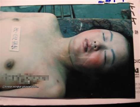 グロ画像遺体安置所で可愛い女の子の裸だけを選んで撮影してきたよ カルログローチェ