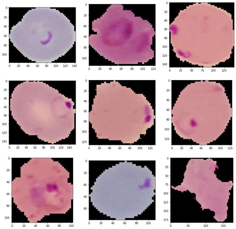malaria affected cells detection using cnn with pytorch by vikrant kc medium