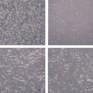 Differentiation Potential Of Human Bone Marrow Derived Mesenchymal Stem