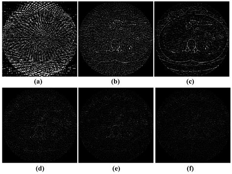 applied sciences free full text sparse view computed tomography reconstruction based on a