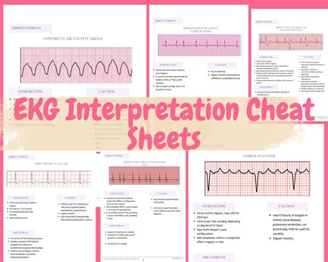 ECG Interpretation Cheat Sheet WHAT EXACTLY IS AN ECG An