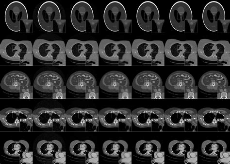 figure 2 from low dose ct reconstruction using deep generative regularization prior semantic