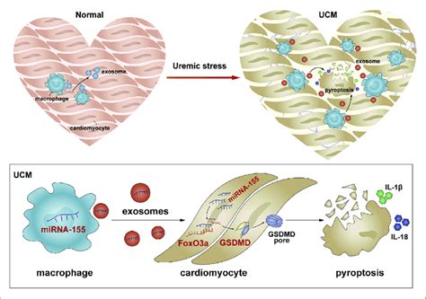 Working Model Of Macrophage Derived Mir 155 Containing Exosomes Promote