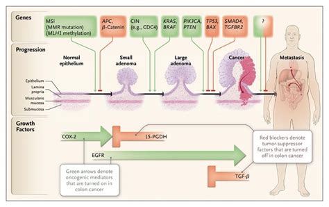 molecular basis of colorectal cancer nejm