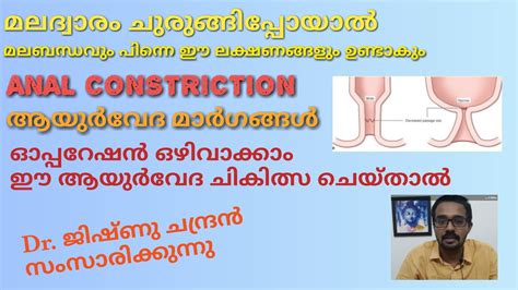 047 മലദ്വാരം ചുരുങ്ങിപോയാൽ എന്താണ് ചെയ്യേണ്ടത് Anal Stricture Constriction Drjishnu