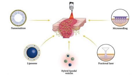 Pharmaceuticals Free Full Text Micro And Nano Based Transdermal