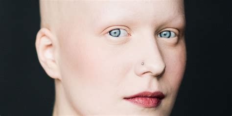 7 Stunning Portraits Of Women With Alopecia Redefine Femininity
