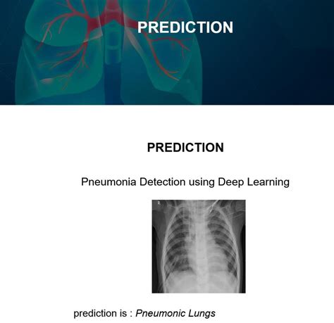 jppy2209 pneumonia detection using deep learning jp infotech