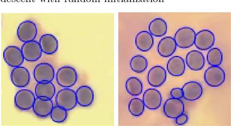 [pdf] cell nuclei segmentation in cytological images using fuzzy clustering and ellipse fitting
