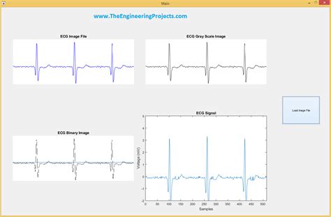 ecg digitization in matlab the engineering projects