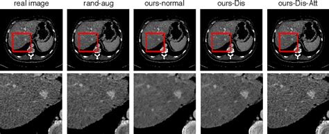 figure 1 from inter slice image augmentation based on frame interpolation for boosting medical