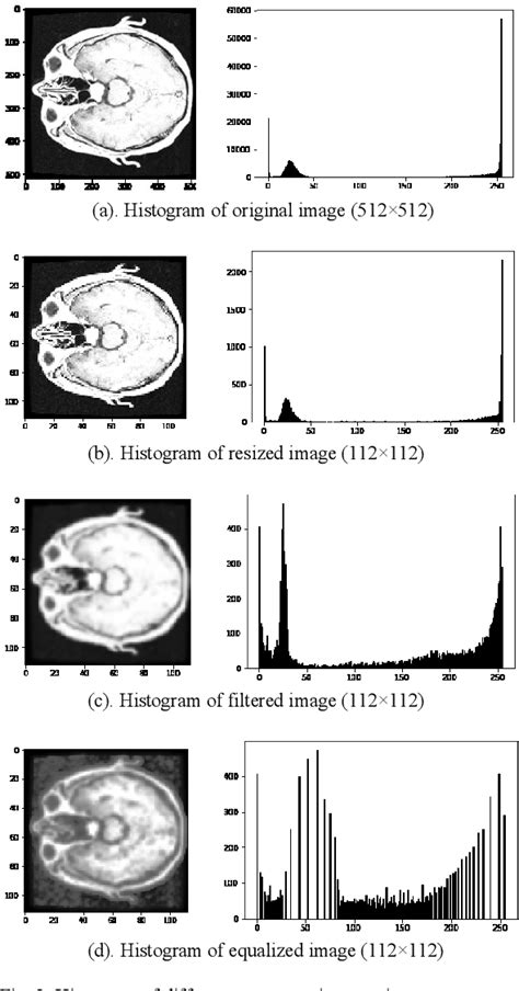 brain tumor classification using convolutional neural network semantic scholar