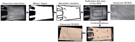 3d palmprint recognition using unsupervised convolutional deep learning network and svm