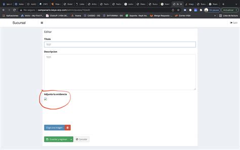 Images Not Showing In Update Function Using BackPack For Laravel