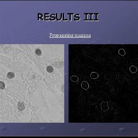 boundary detection using the redundant wavelet transform and filtering download scientific