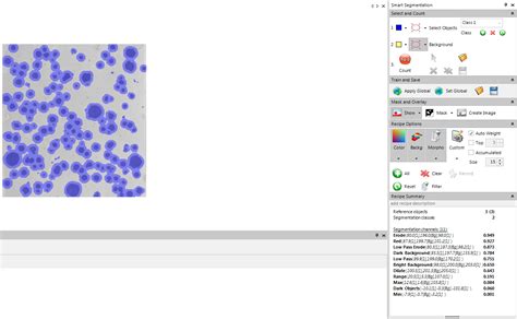 smart segmentation issue — media cybernetics image analysis forums