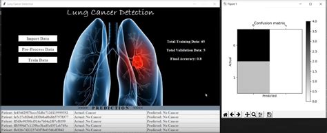 github priyansh42 lung cancer detection this application aims to early detection of lung