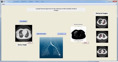 online matlab projects lung cancer detection using image processing techniques