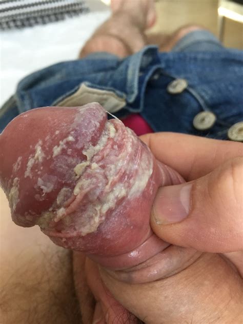Smegmalicker Tumblr Tumbex 5824 The Best Porn Website