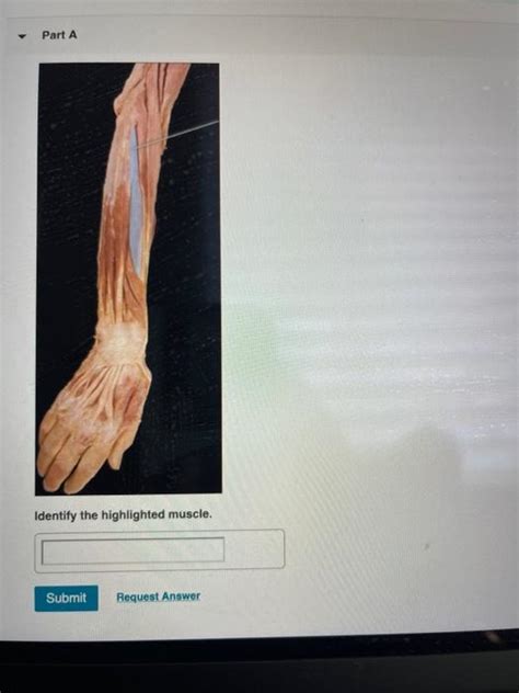 Solved Muscular System Upper Limb Lab Practical Pal Chegg