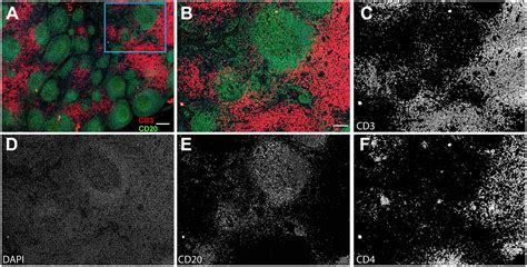 Spatially Resolved And Highly Multiplexed Protein And RNA In Situ