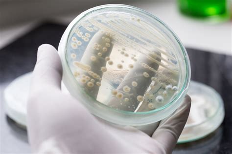 3 Natural Remedies For Yeast Infections