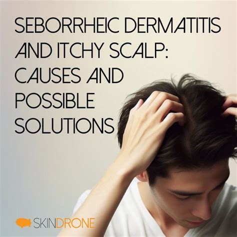 Seborrheic Dermatitis And Itchy Scalp Causes And Possible Solutions Skindrone