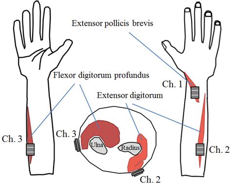 hand sign classification employing myoelectric signals of forearm intechopen