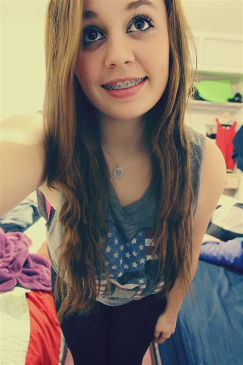 Braces Selfie Girl Dental Braces Brace Face
