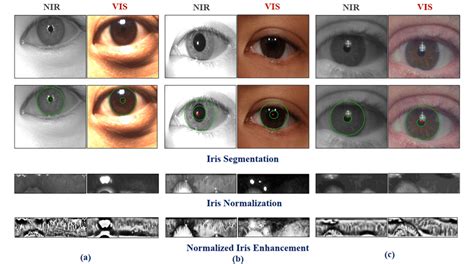 iris image preprocessing steps segmentation normalization download scientific diagram