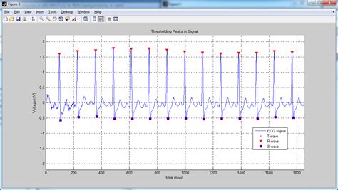 biomedical signal and image processing projects using matlab and labview tools matlab code to