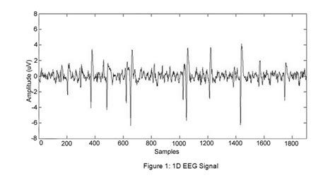 wavelet transform for classification of eeg signal using svm and ann biomedical and